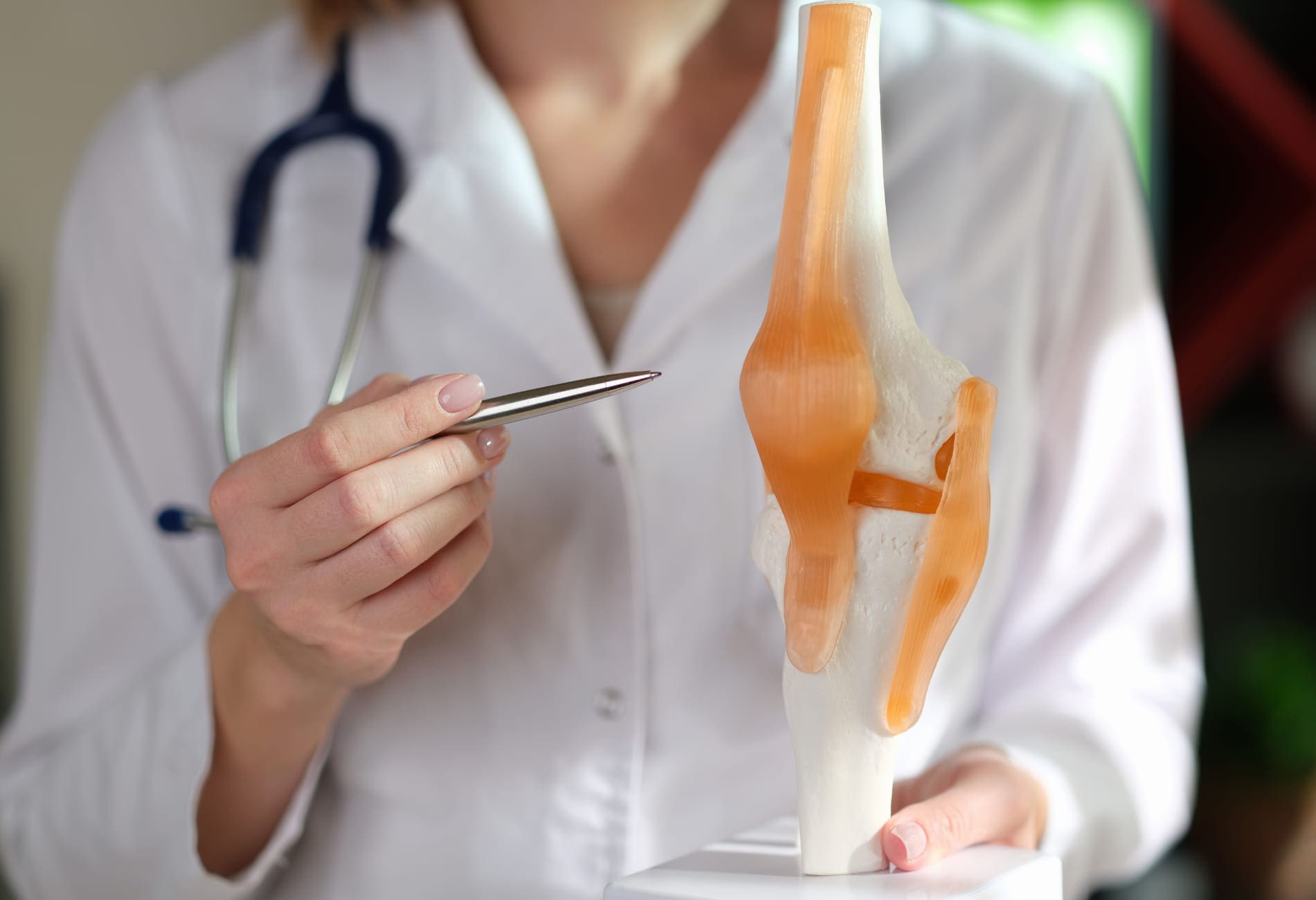 Como que é feita a cirurgia para artrose no joelho? - Instituto Trata