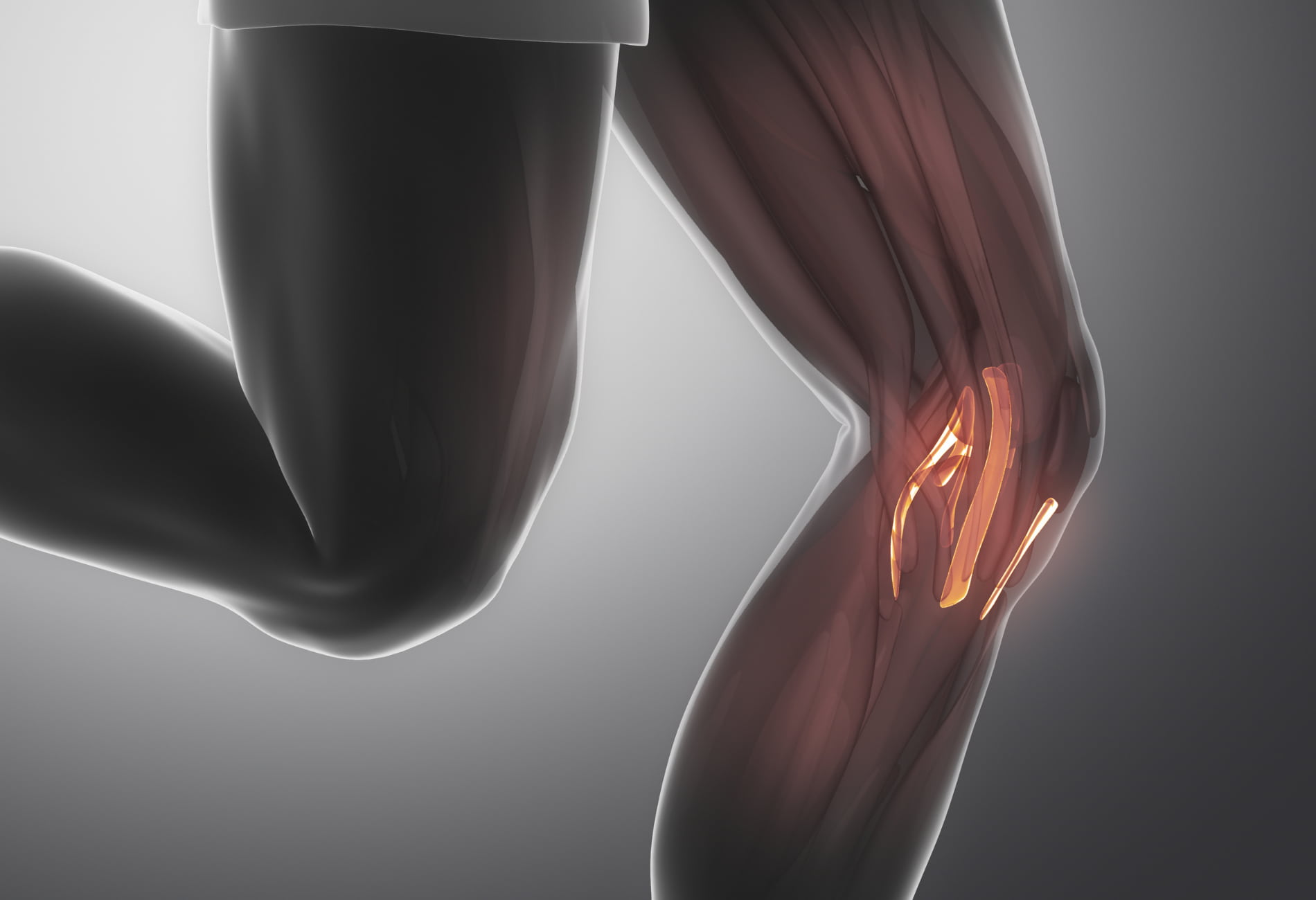 Como saber quando a dor no joelho na parte interna é preocupante ...